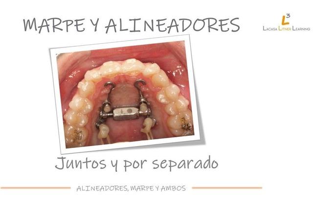 Detalle de Producto - Formación: Curso MARPE Y ALINEADORES 10-11 Mayo ...